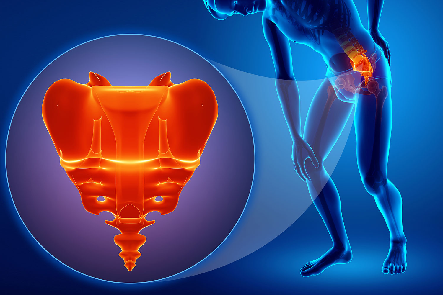 Sacroiliac Joint Fusion (SI Fusion) - GTI PAIN